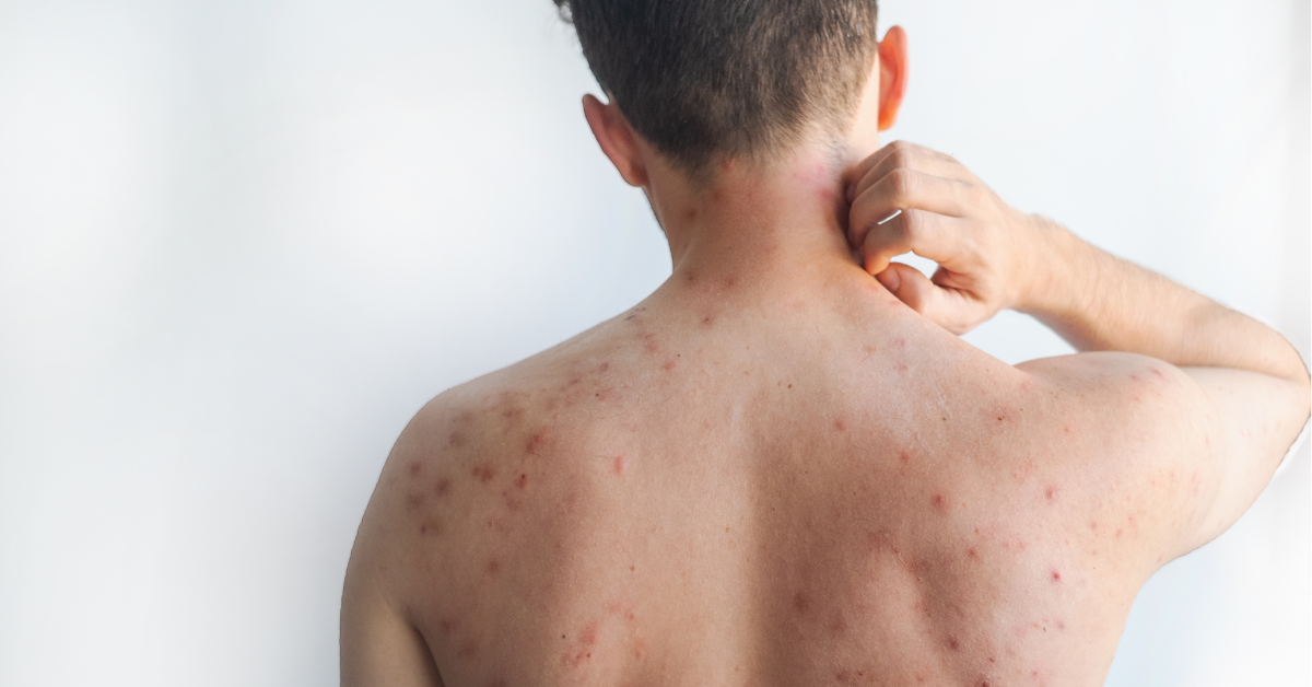 Early Signs of Sinus Infection | Shanti Nursing Home